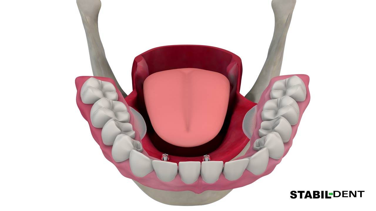 3D Medical Animation Portfolio | JLab Work